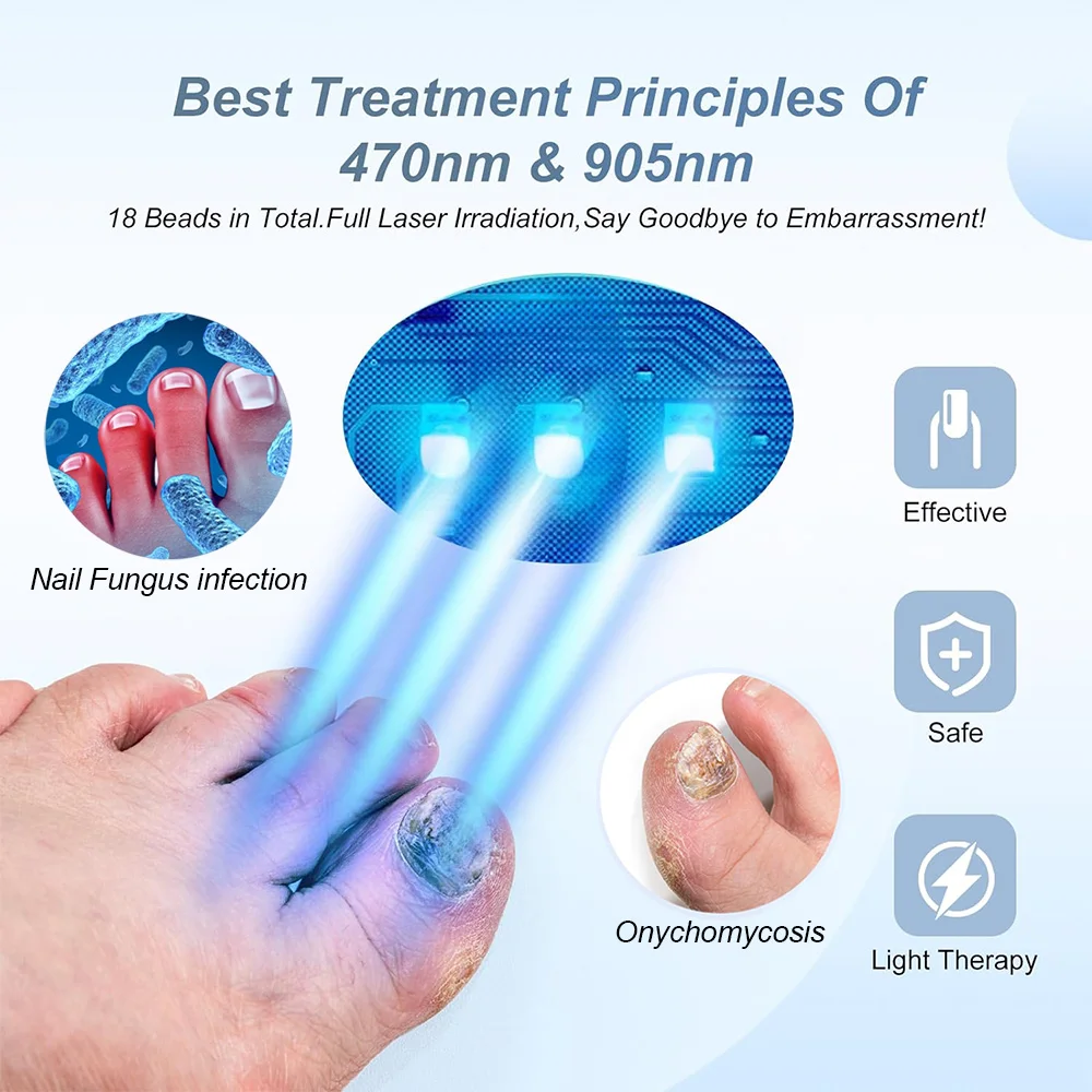 Nail Laser Fungus Device for Multiple Toenails & fingernails Nail ...